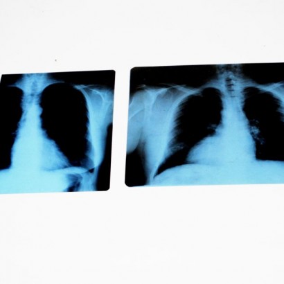 X-Rays - Theme Prop Hire